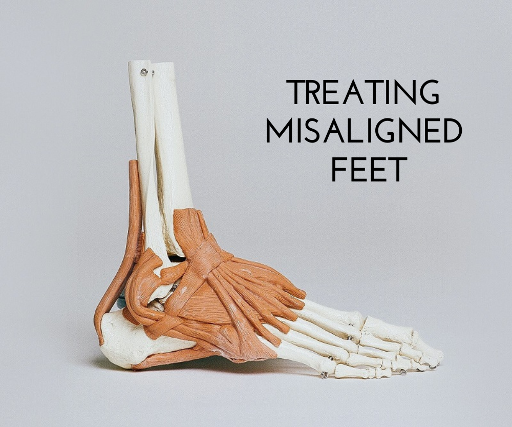 Treating Misaligned Feet - Ankle & Foot Centers of Mid-America